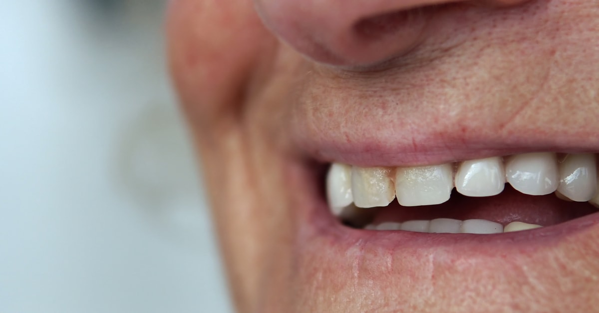 Zorg voor goede mondzorg: zo doe je dat