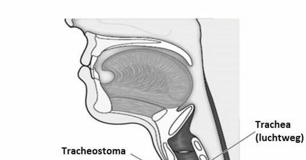 Anatomie Der Tracheostomie Menselijk Strottenhoofd Anatomie