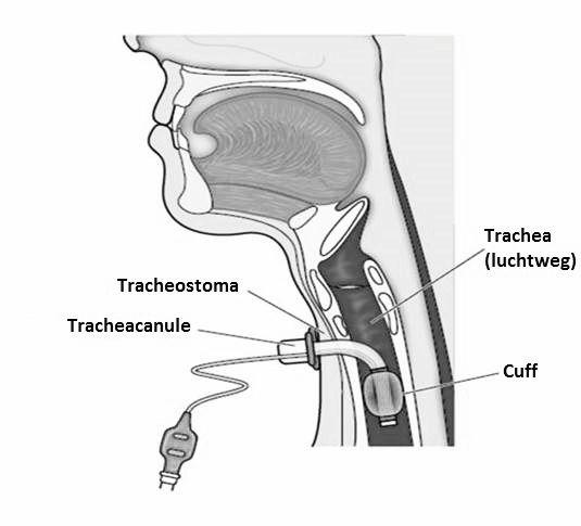 Anatomie Der Tracheostomie Menselijk Strottenhoofd Anatomie